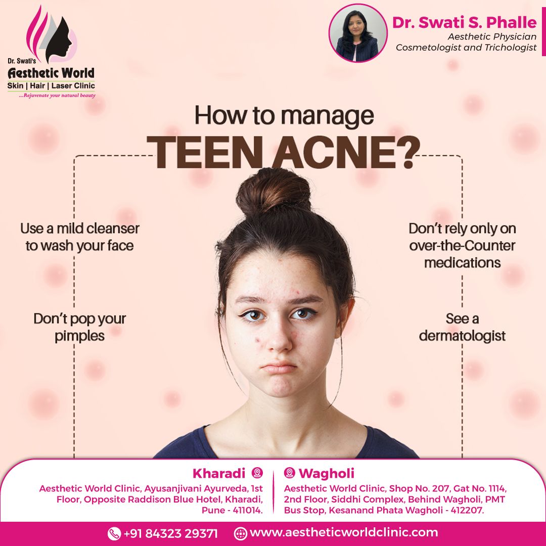 How to manage teen acne before it starts, tips for Teens....