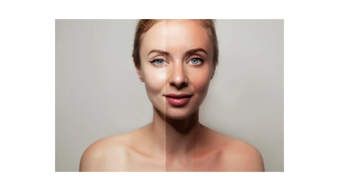 Tanning in Summer its Causes and 5 Effective Prevention Tips